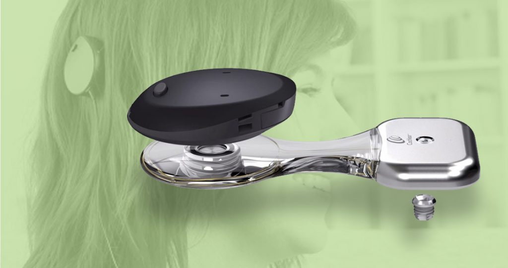 Cochlear Received FDA Clearance for Osia, a New Type of Implantable Hearing Solution ...